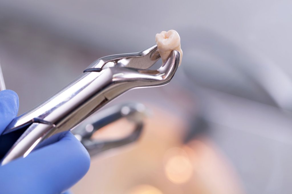 Tooth Extractions - Safe & Gentle Care | GLEAM Dental